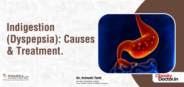 Indigestion (Dyspepsia): Causes & Treatment - Dr AvinashTank, is a ...