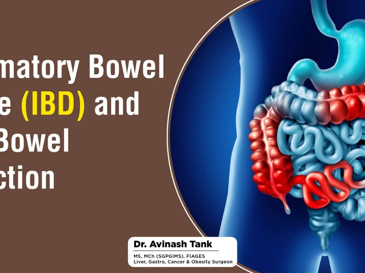 Small Bowel Obstruction