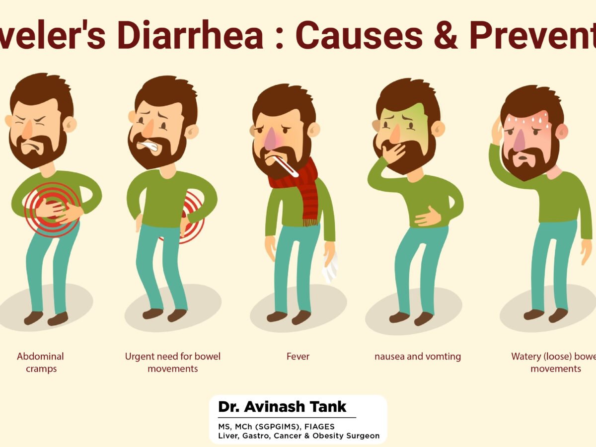 Causes Of Nausea And Diarrhea