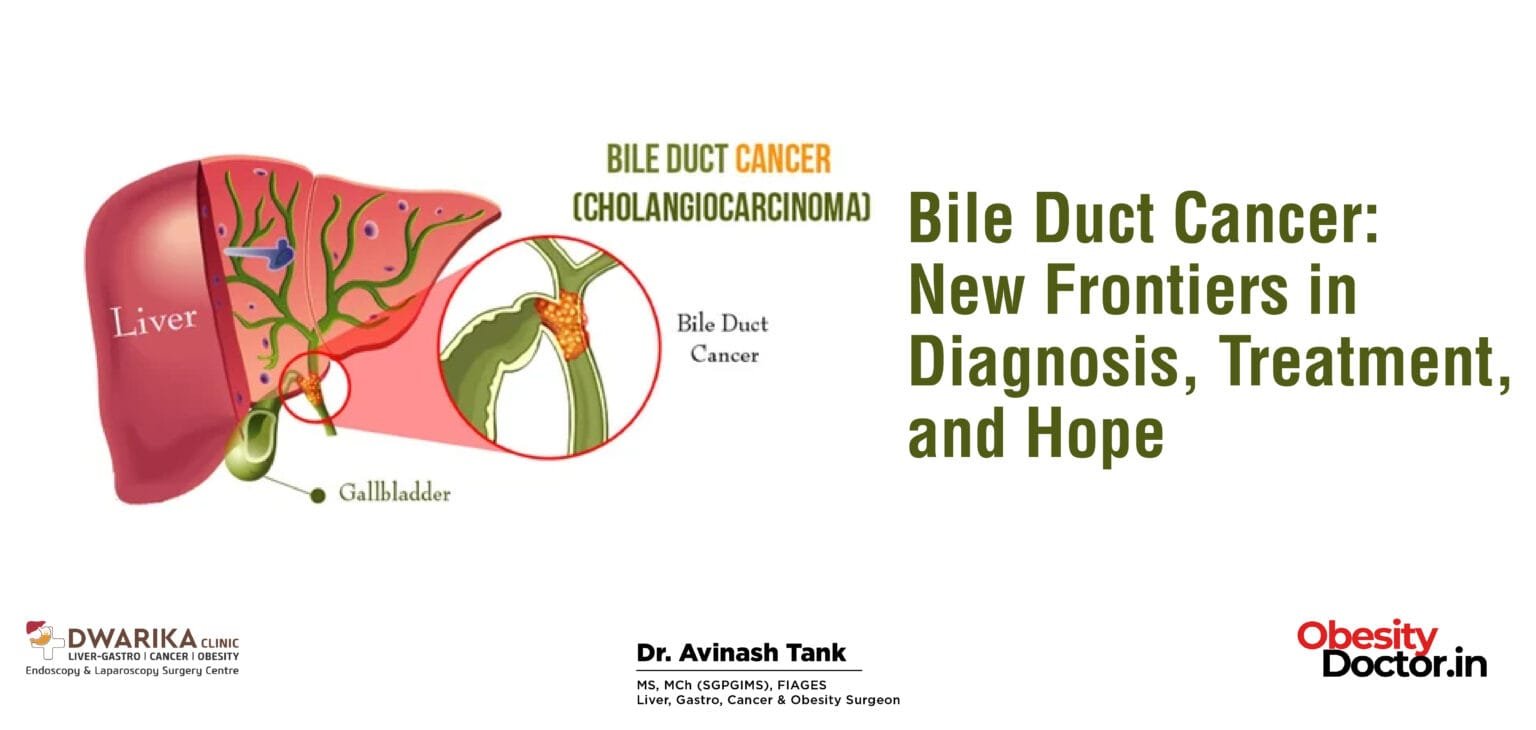 Bile Duct Cancer: New Frontiers in Diagnosis, Treatment, and Hope - Dr ...