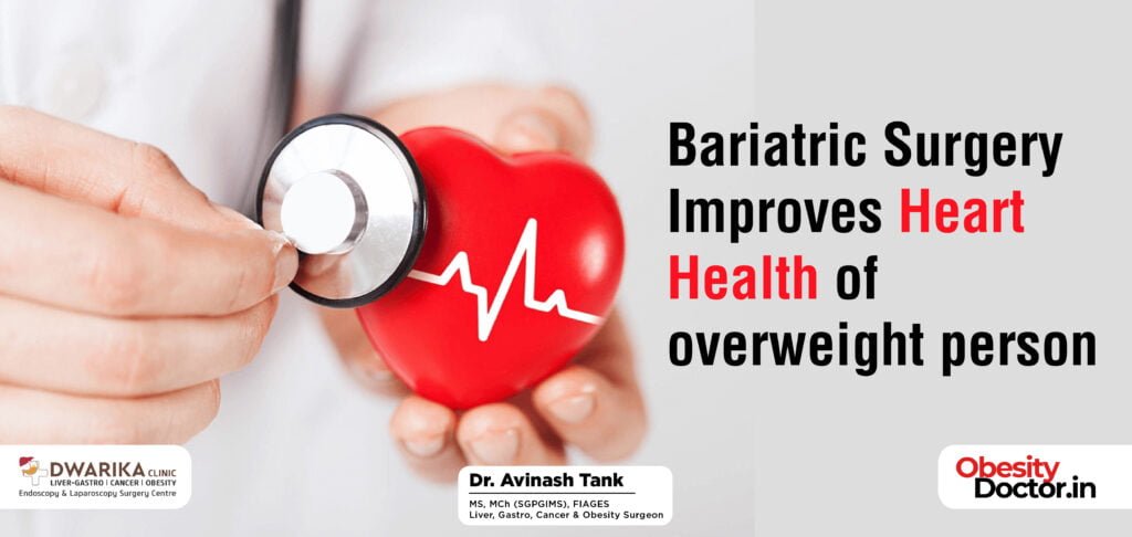 Bariatric Surgery Improves Heart Health of overweight person - Dr ...