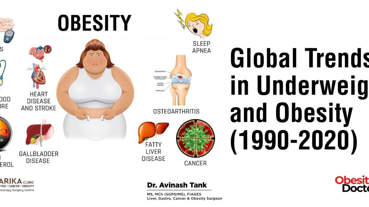 Causes Of Being Underweight Body Mass Index (BMI) In Adults: