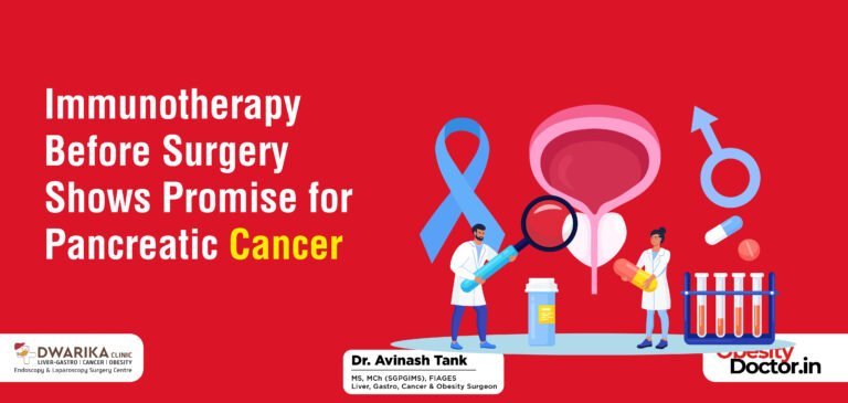 Immunotherapy Before Surgery Shows Promise for Pancreatic Cancer - Dr ...
