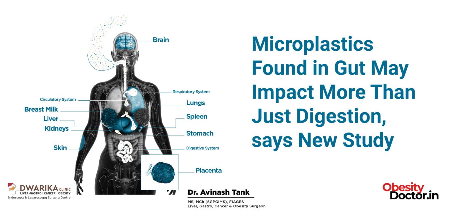 Microplastics Found in Gut May Impact More Than Just Digestion, says ...