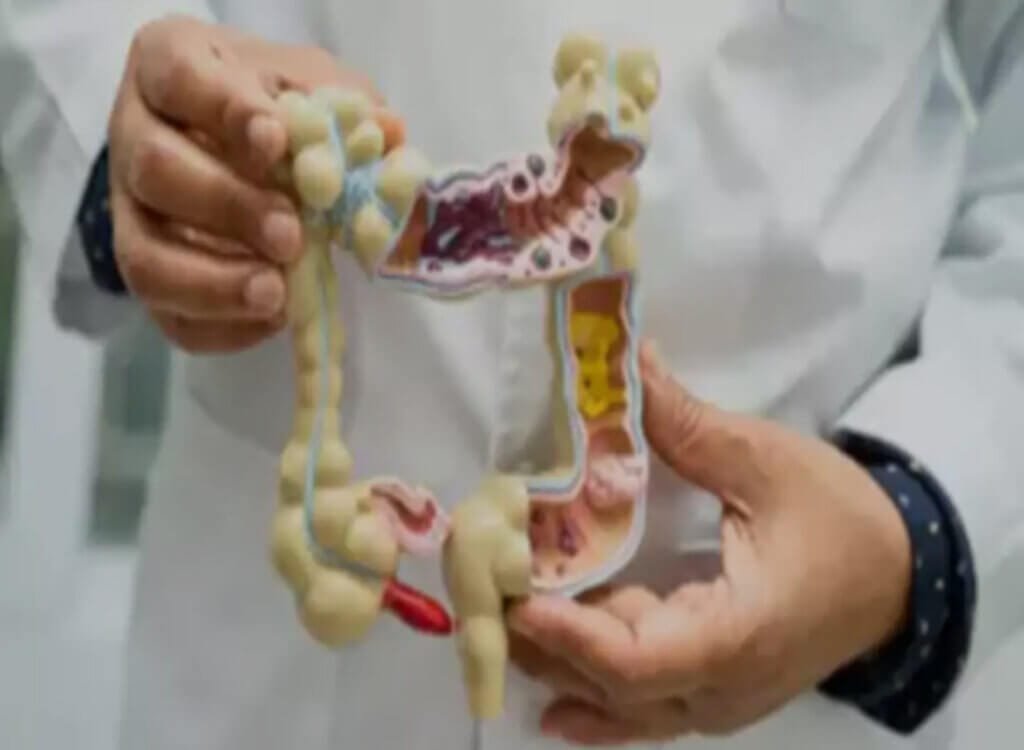 Appendicectomy Reduces Relapse in Ulcerative Colitis: ACCURE Trial - Dr ...